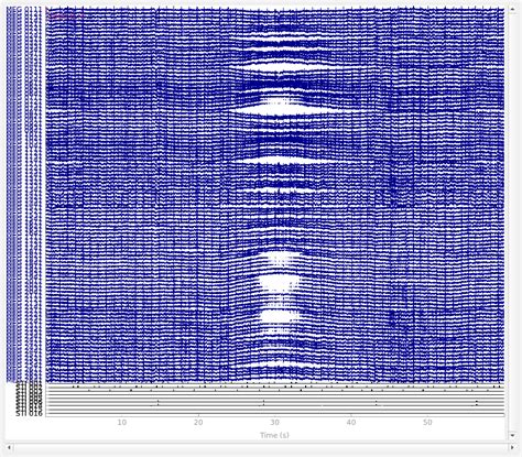 filtering and resampling data — mne 1 5 1 documentation