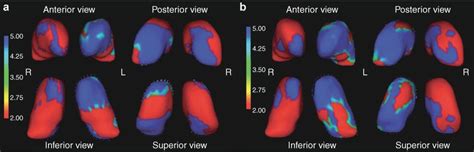 Shape Correlation Analysis Between Thalamic Regions A Full