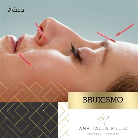 A Acupuntura Para Bruxismo Dra Ana Paula Mello