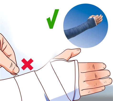 Як правильно доглядати за гіпсом поради травматолога у м Рівне