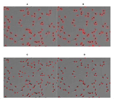 Figure E Sample Comparison Of Sperm Target Detection Results A