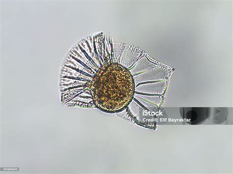 Ornithocercus Steinii Algae Under Microscopic View Chromista Diatoms
