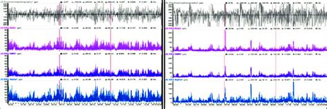 Figure Showing Pre Test And Post Test Intervention Of Eeg Bands Download Scientific Diagram