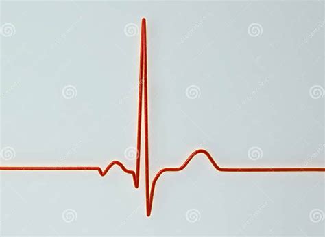 A Normal Electrocardiogram 3d Illustration Displaying The Electrical