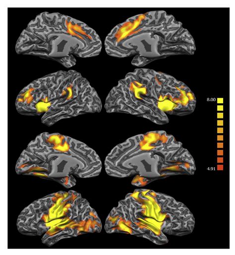 Figure 1 From Functional Connectivity Of The Insula In The Resting