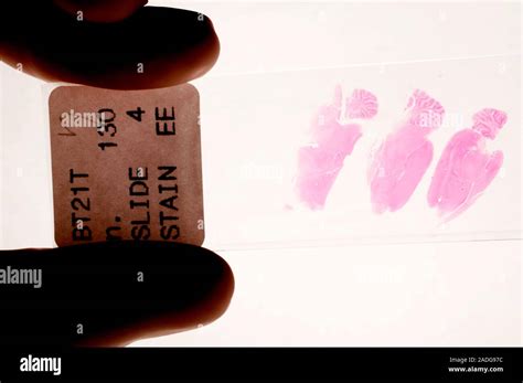 Rat Brain Microscope Slides Fingers Hold A Microscope Slide Of Stained Sections Of Rat Brain