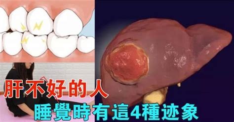 肝不好，睡覺時，會有這4種跡象，你若佔1個，說明你「肝功能」已經很差了！