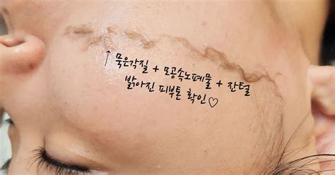 스킨플래닝 김세인 숨고 숨은고수