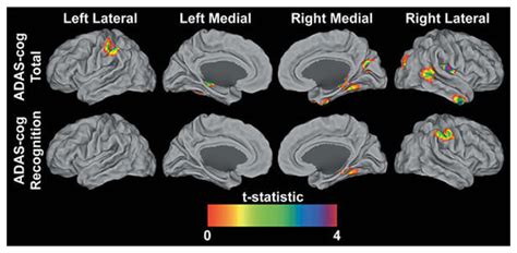 Statistical Parametric Maps At P