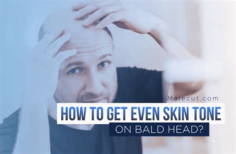How To Get Even Skin Tone On Bald Head 6 Best Methods