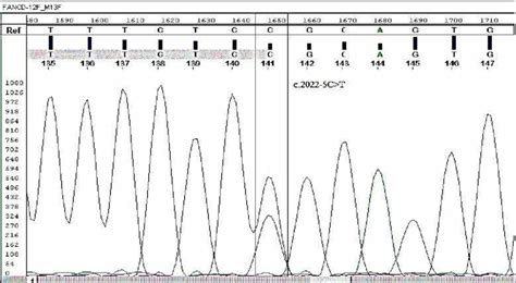 Electropherogram Showing Mutation C T In Fancd2 At Splice Site Of