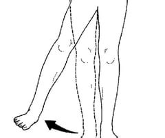Chapter 29 Practice Questions Physical Activity Immobility