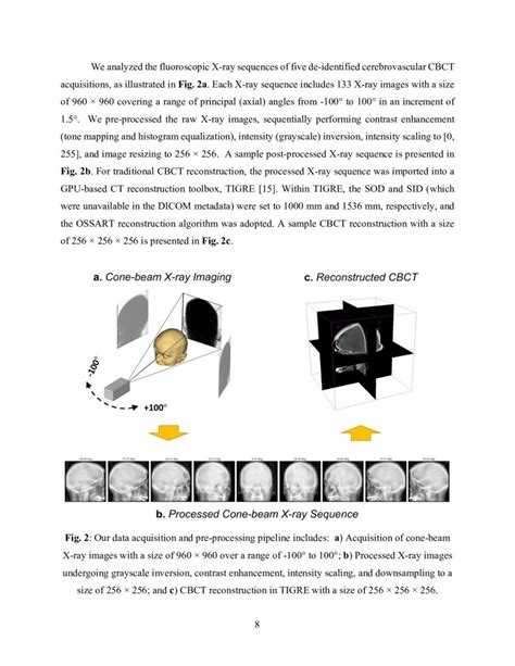 Robust Single View Cone Beam X Ray Pose Estimation With Neural Tuned Tomography Nett And