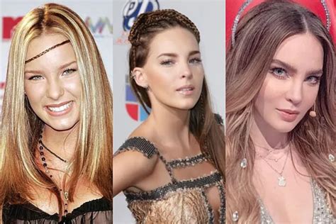 El Impactante Cambio De Belinda Antes De Su Cirugía Estética Aelaes