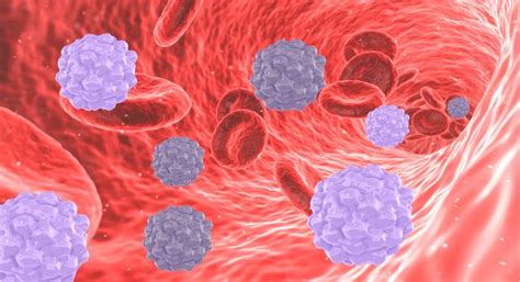 Global Hematological Malignancy Treatment Market Report Sd Research News Posted On The Topic