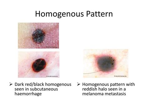 Ppt Dermatology Gp Education And Networking Event Powerpoint