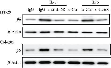 Upregulation Of Integrin β6 Is Critical To Il 6 Il 6r Induced Invasion
