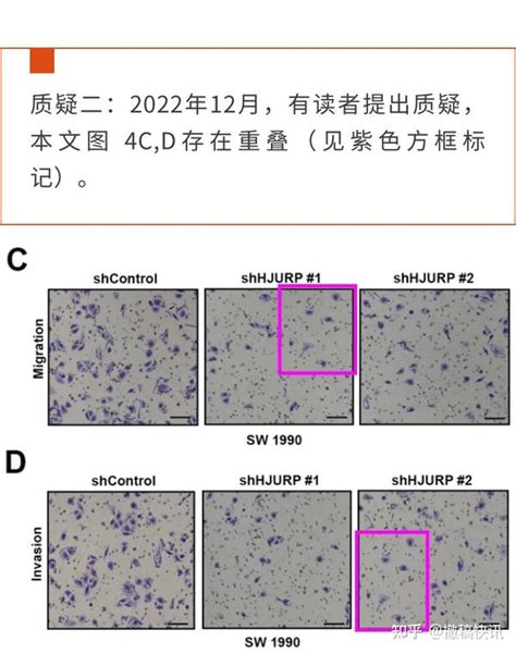 青岛大学附属医院的1区论文因大量图片重复受质疑 知乎