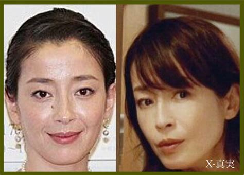 2023｜宮沢りえの顔が変わった？！肌ツヤ復活でシワが消えた？画像比較！ X 真実