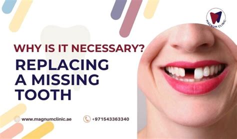 Replacing A Missing Tooth 5 Reasons Why Is It Necessary