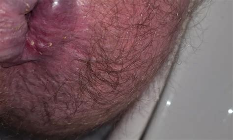 Quick Close Up Poo