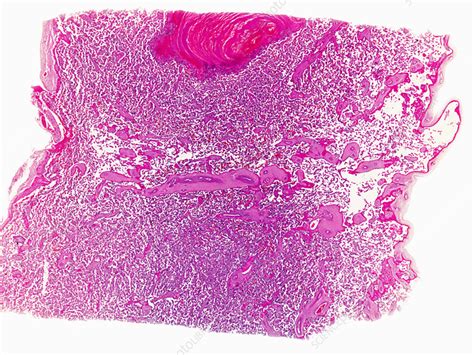 Human Placenta Light Micrograph Stock Image C0556293 Science