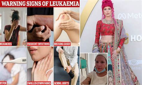 The Eight Warning Signs Of Leukemia You Should Never Ignore