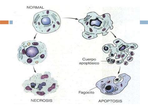 Lesion Celular Reversible E Irreversible