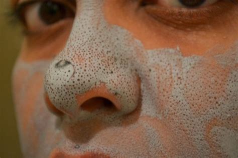 შავი წერტილების მტერი ნიღაბი რომელიც 2 კომპონენტისგან შედგება და ეფექტურობით გამოირჩევა