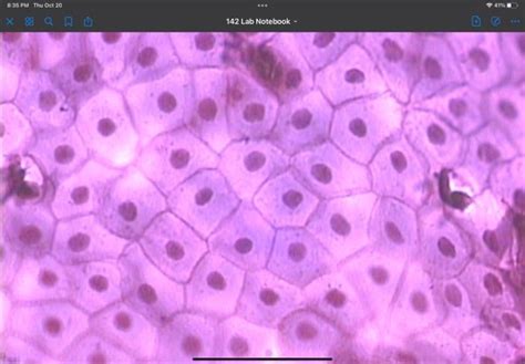 Epithelial Tissue Id Flashcards Quizlet
