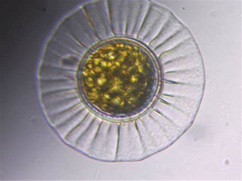 Coscinodiscus C G Ehrenberg 1839