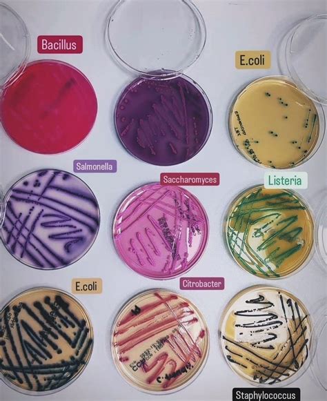 Macconkey Agar Plate Purpose Ingredients And Principle Artofit