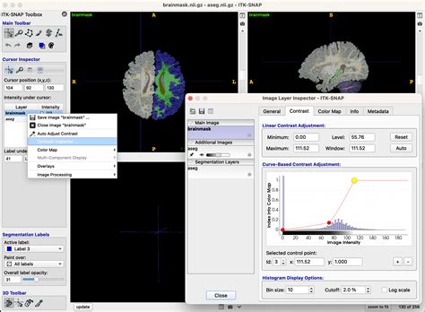 Itk Snap Tutorial 2 The Itk Snap Gui — Andys Brain Book 10