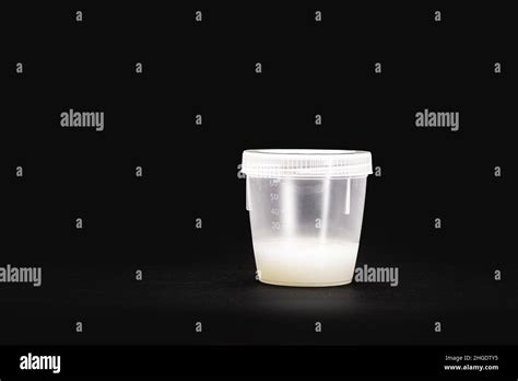 Collection Bottle Or Sample Container With Male Semen For Sperm Analysis Stock Photo Alamy