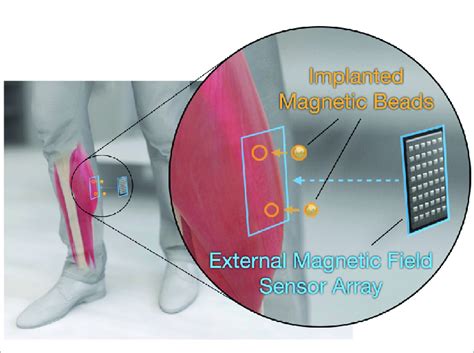 Tracking Muscle Tissue Lengths Via Muscle Magnetomicrometry