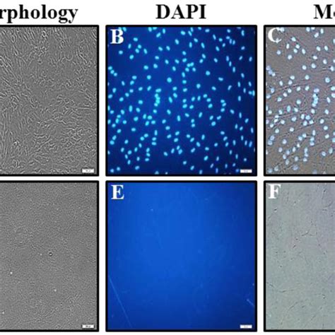 Decellularization Of Chondrocyte Derived Extracellular Matrix Was