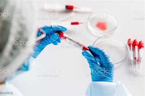 전염병 코로나 바이러스 혈액 검사를 들고 의사 긍정적 인 결과 급속하게 확산 코로나 바이러스 중국 2019ncov에 대한 샘플