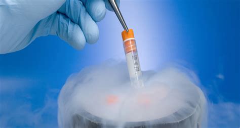 Single Cell Rna Sequencing From Frozen Samples Feasible Rna Seq Blog