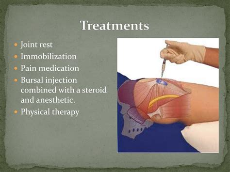 Ppt Bursitis Powerpoint Presentation Free Download Id2322419