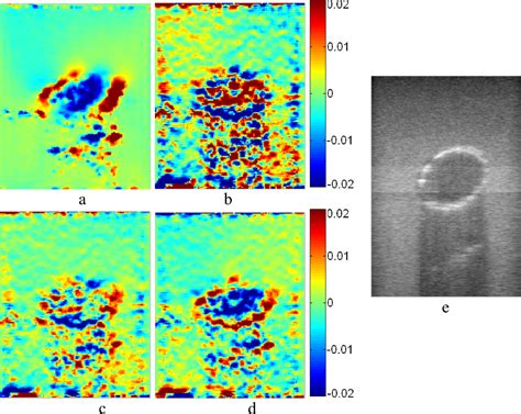 Figure 2 From On The Advantages Of Imaging The Axial Shear Strain