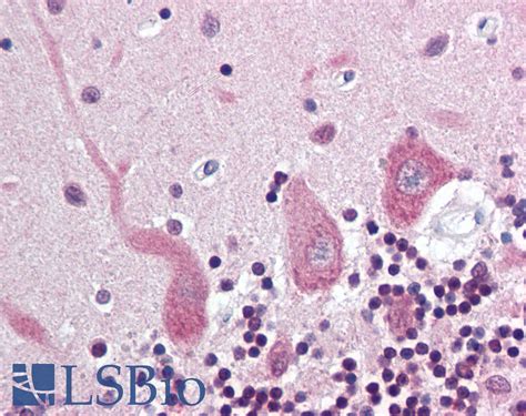 Ihc Plus™ Synuclein Alpha Beta Monoclonal Antibody Mouse Lsbio