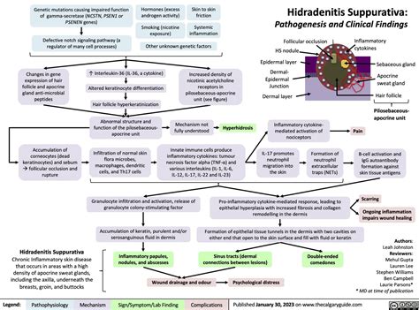 Hidradenitis Suppurativa Calgary Guidecalgary Guide