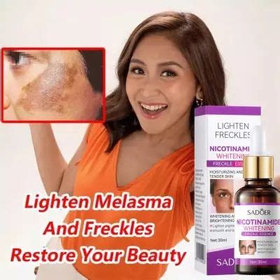 SADOER Whitening Freckle Cream Whitening Serum Blemish Penghilang