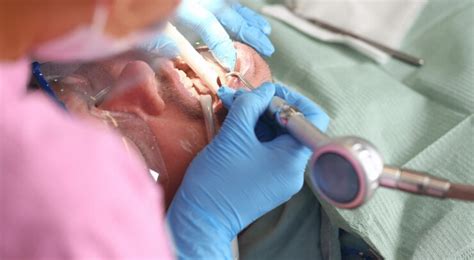 Tooth Extraction In Sinus Cavity At Vivian Nelson Blog