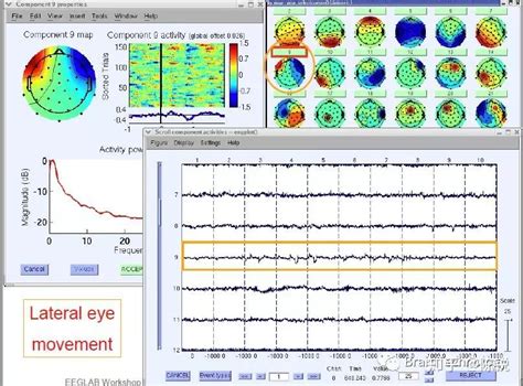 脑电分析之眼电纠正 知乎