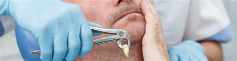 Pain To Relief Your Guide To Emergency Tooth Extractions Bellflower Dental Group