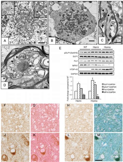 Ultrastructural Evidence Of Abnormal Aggregation Of Mitochondria In Download Scientific Diagram