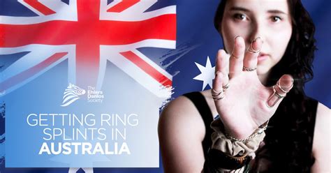 Ring Splints For Ehlers Danlos Syndrome Hypermobility Spectrum Disorders The Ehlers Danlos