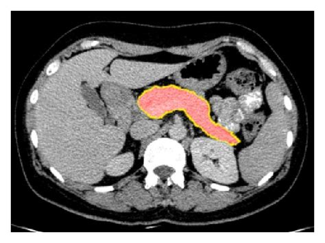 Exemplary Segmentation Results Of Our Proposed Method Based On