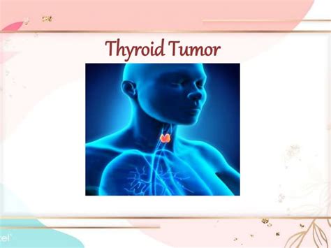 4 Thyroid Tumorpptx Free Download